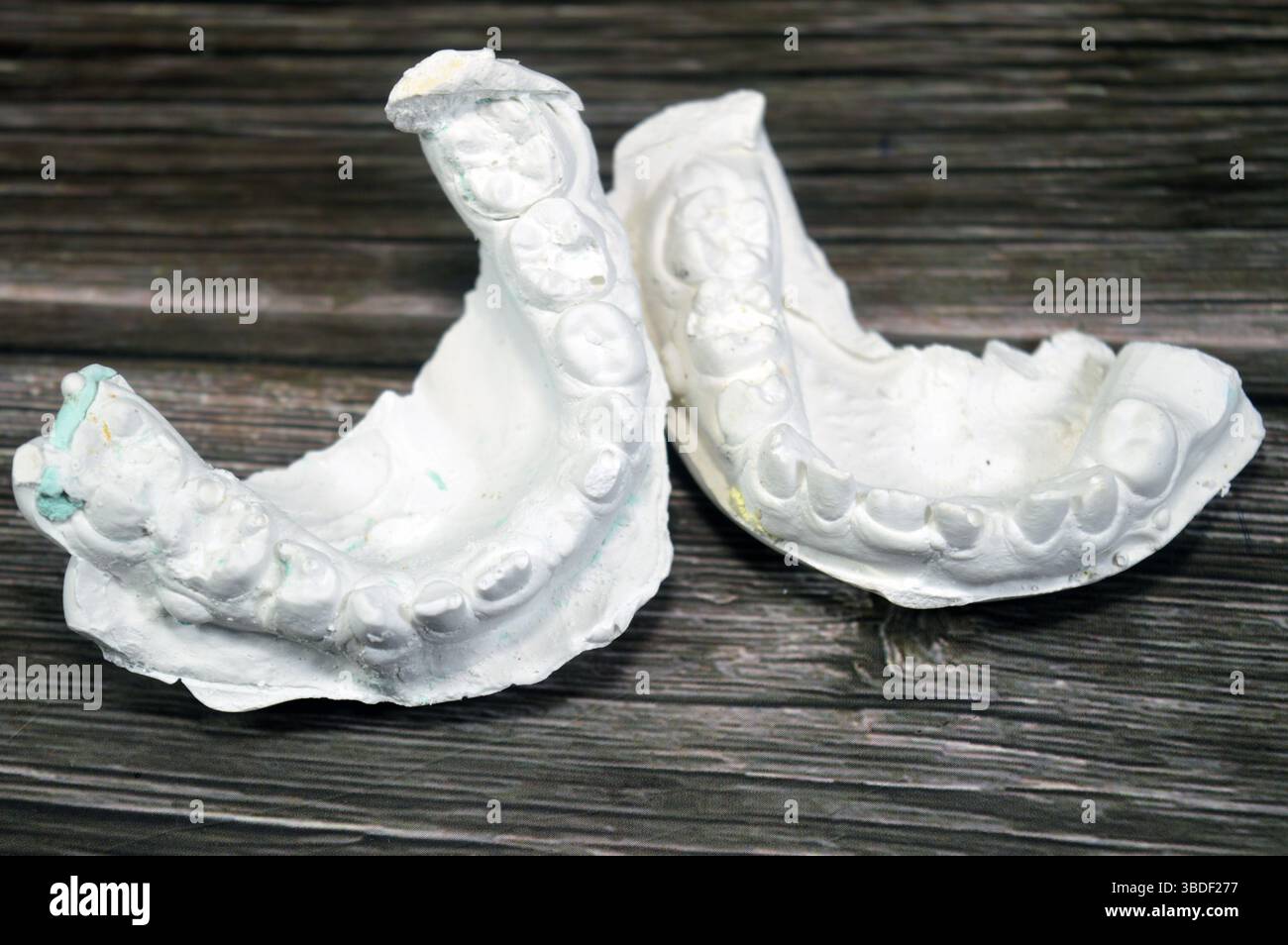 Dental cast model made from impression (a negative imprint of the teeth ...
