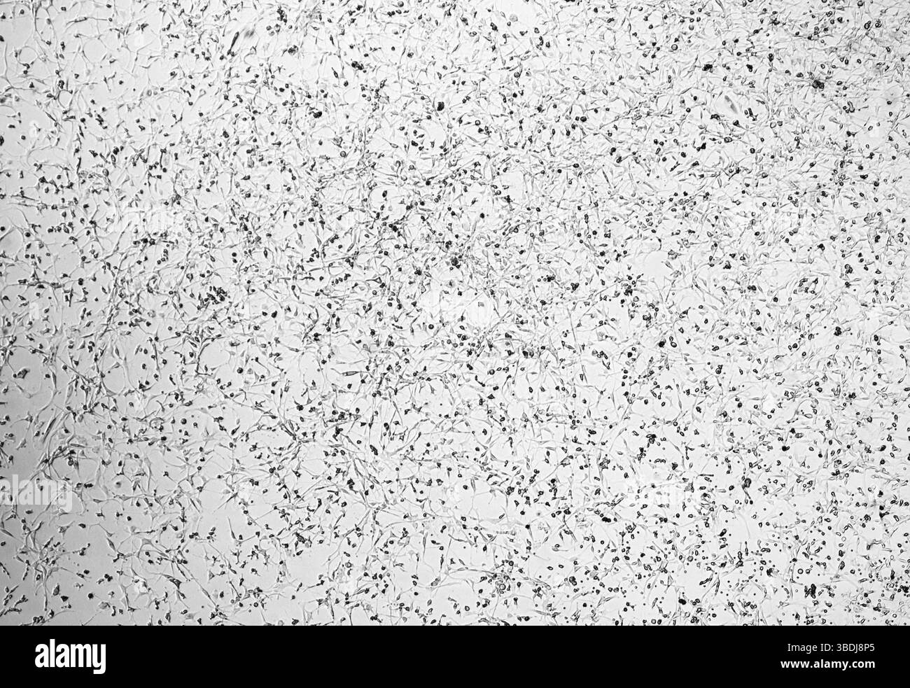 Malignant cell Black and White Stock Photos & Images - Alamy