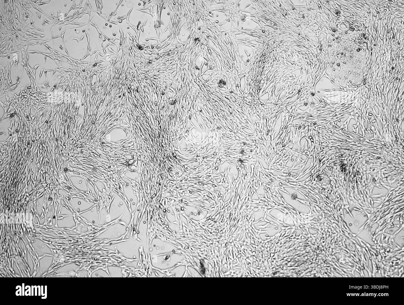 Cancer cells under microscope Black and White Stock Photos & Images - Alamy