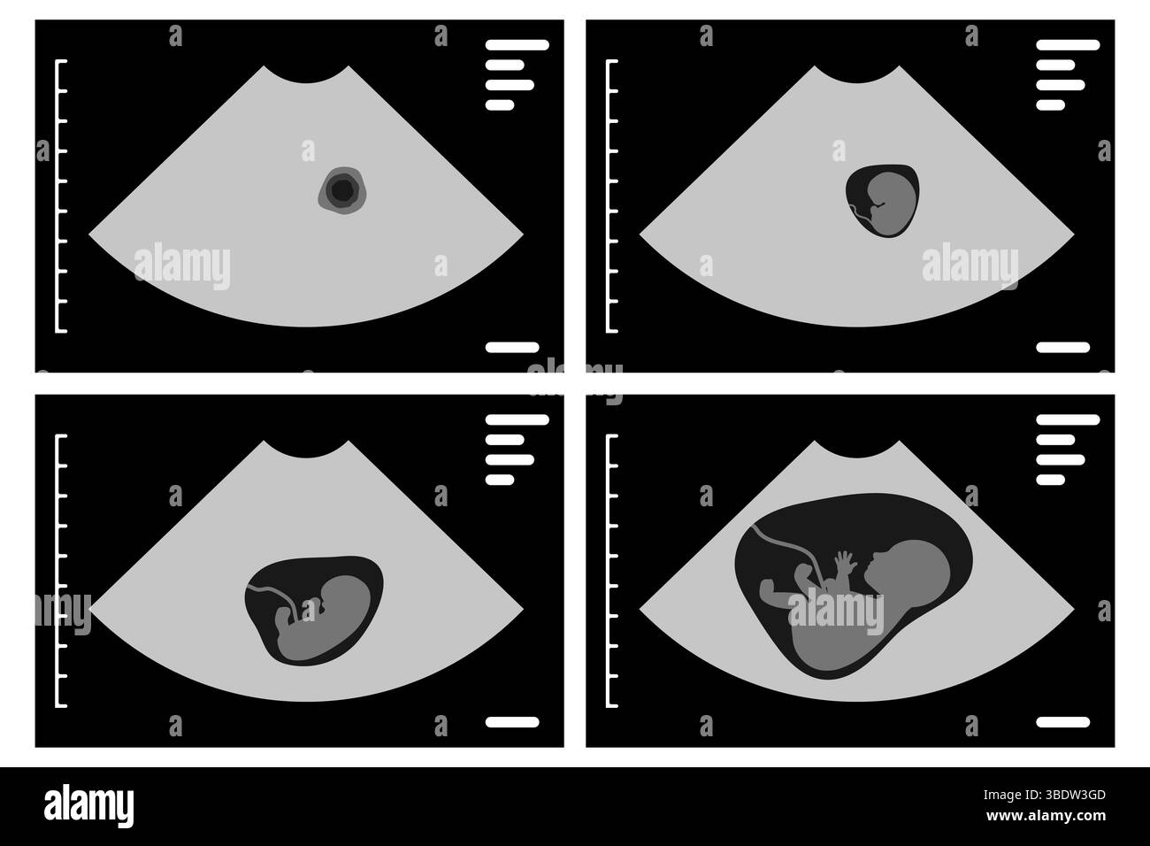 Four ultrasound images showing the different stages of fetal growth ...