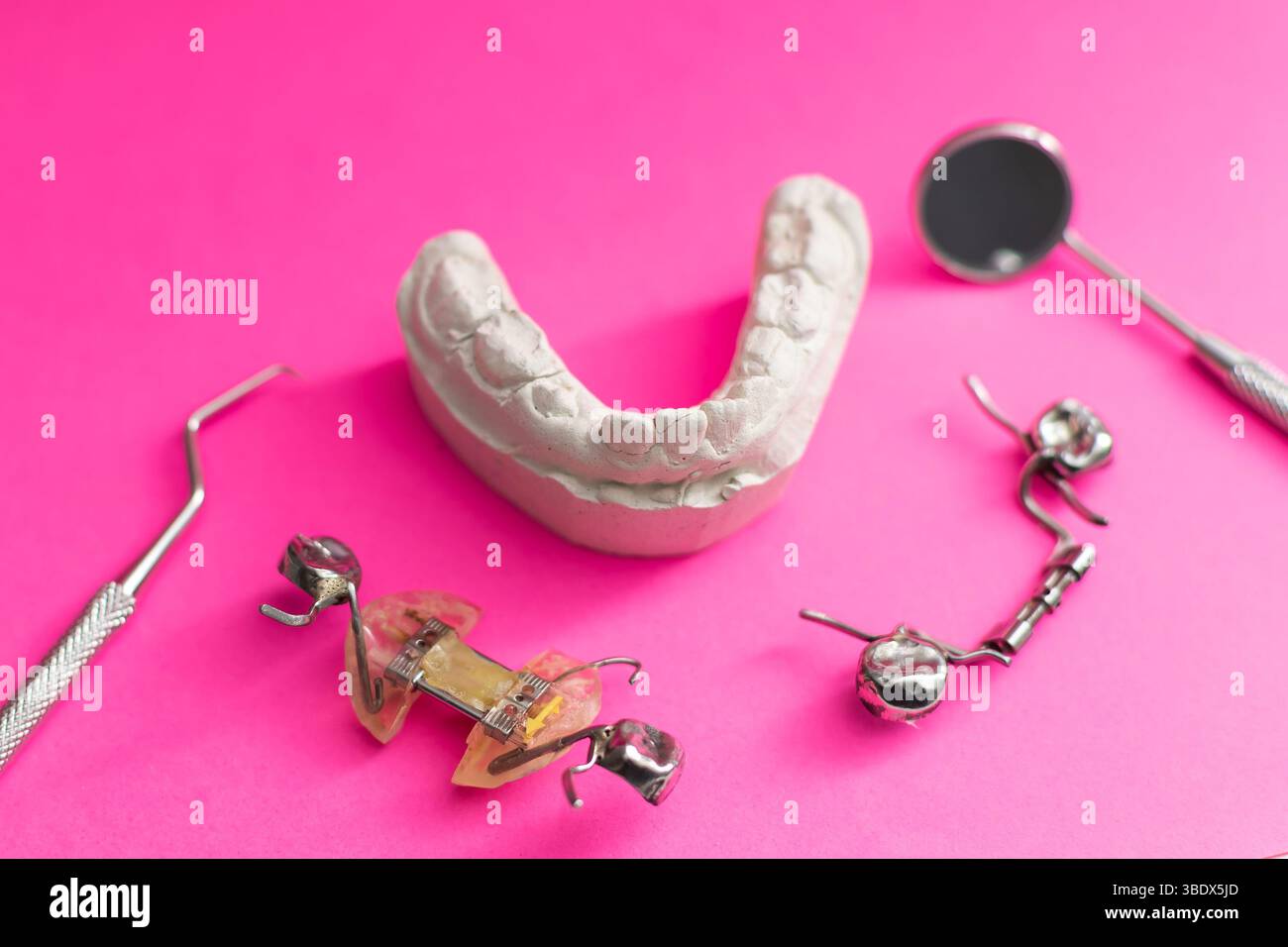 Dental casting gypsum model of human jaws. Crooked teeth and distal ...