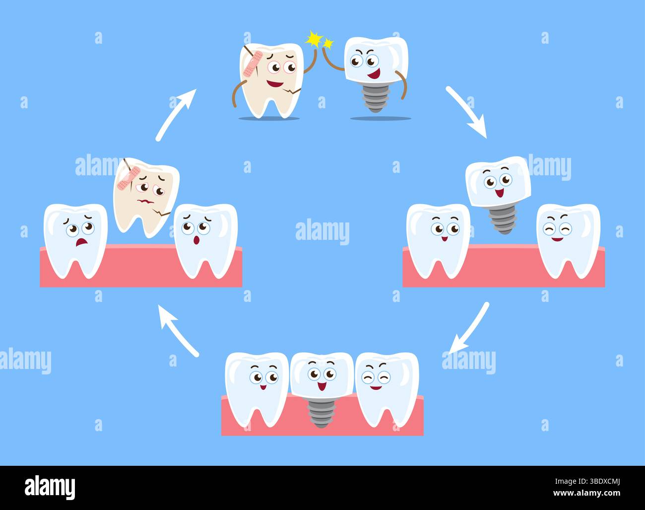 Dental implant procedure . Cartoon character illustration . Isolated on ...