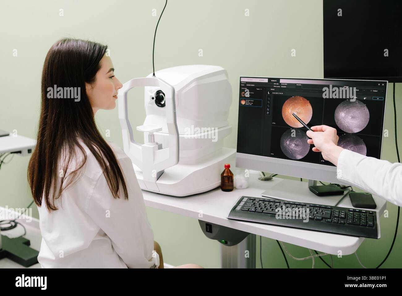 Detailed eye image for diagnosing glaucoma, macular degeneration, and ...