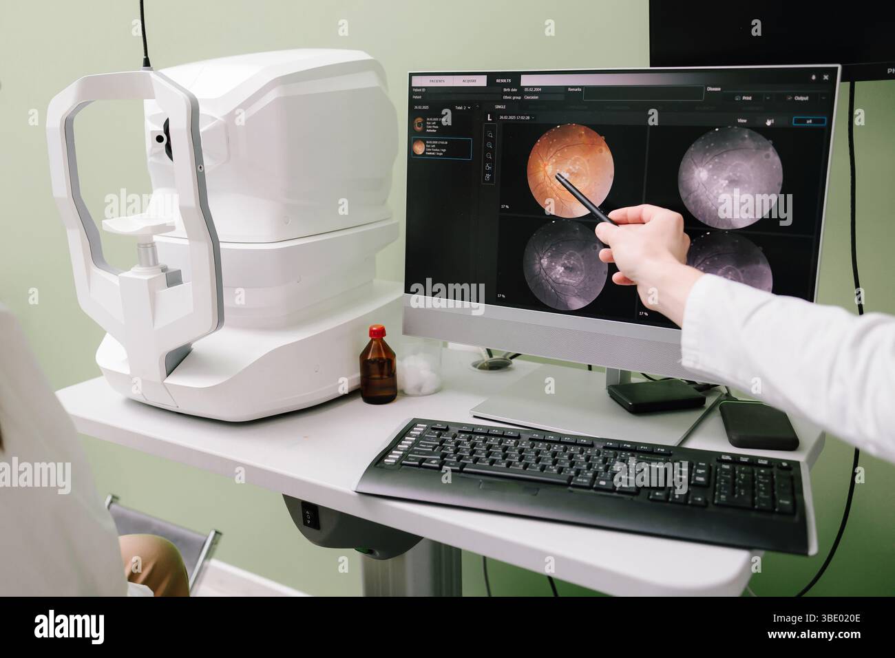 Retinal scan analysis for vision health, optic nerve evaluation, and ...