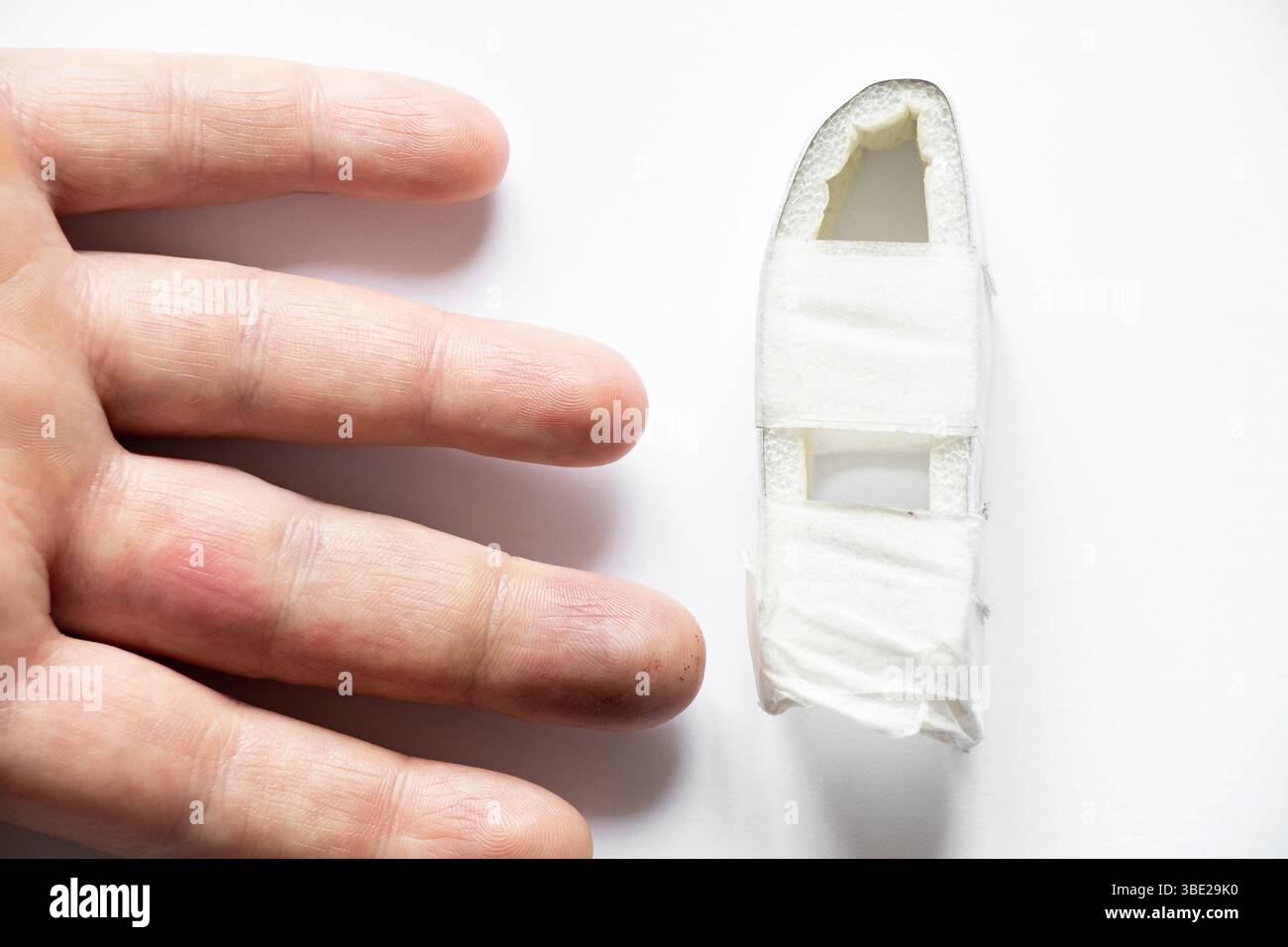 Broken male finger on hand and fixator for broken finger on white ...