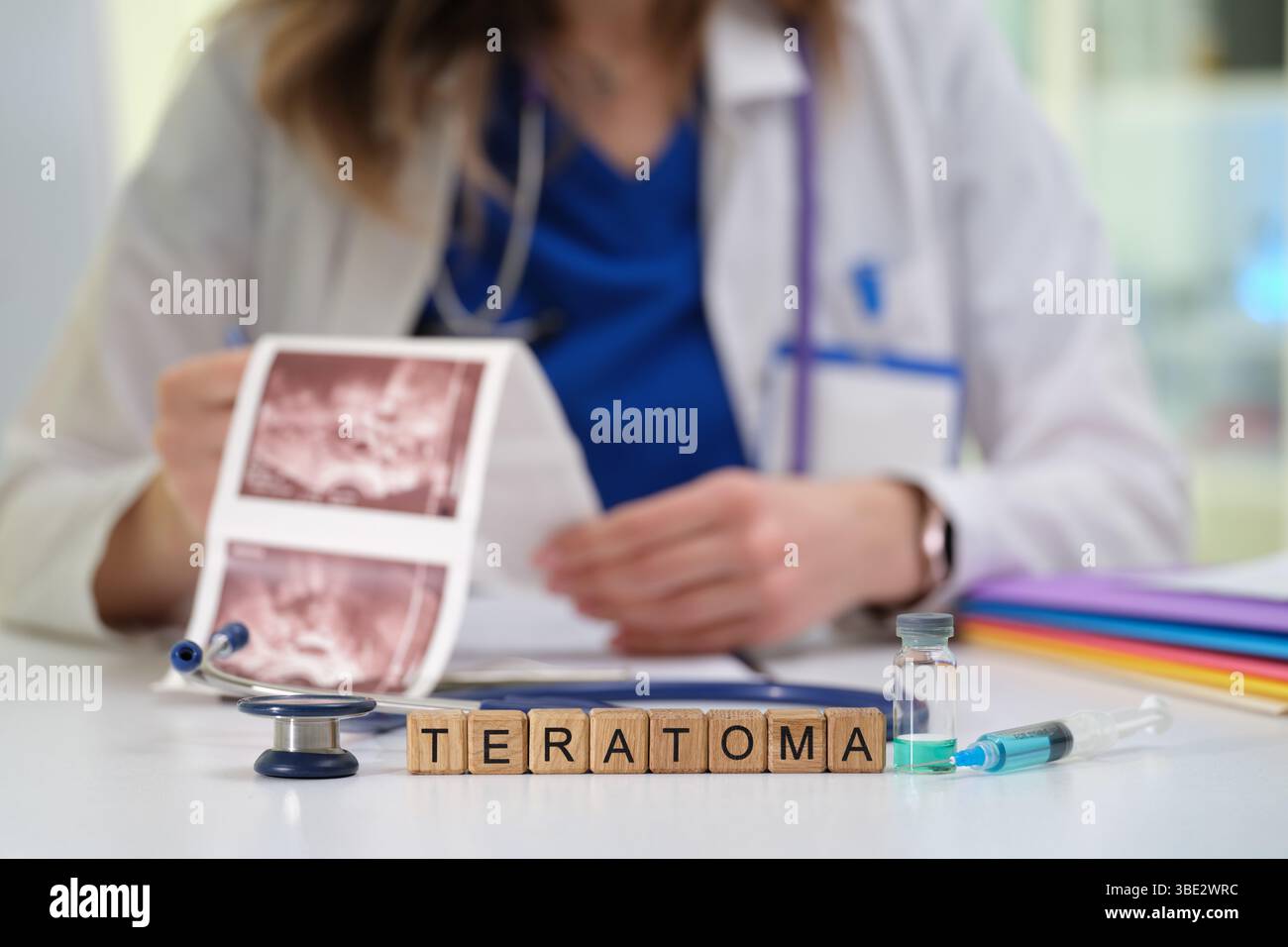 Medical Consultation A Comprehensive Understanding of Teratomas and ...