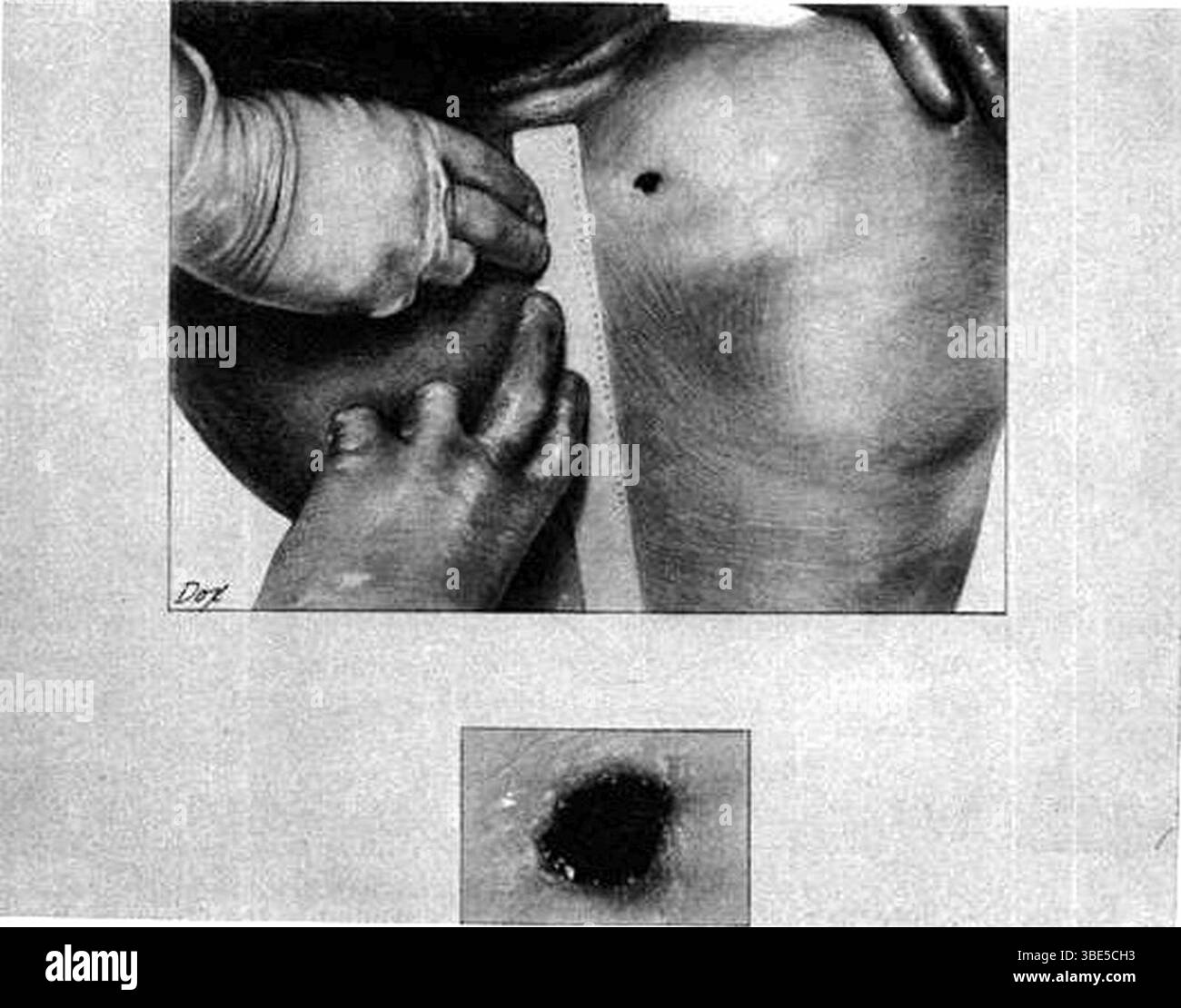 JFK posterior back wound Stock Photo - Alamy