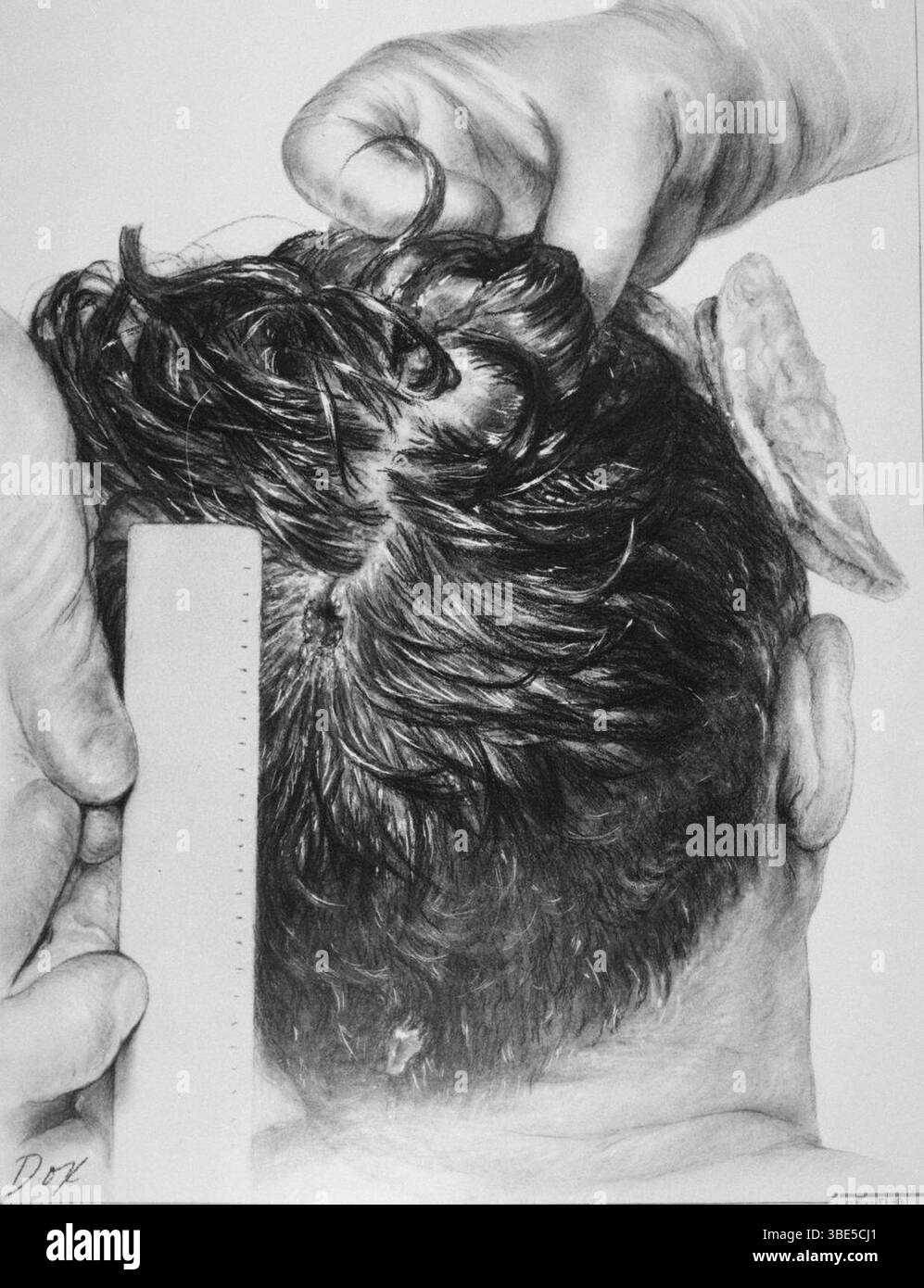 JFK posterior head wound Stock Photo - Alamy