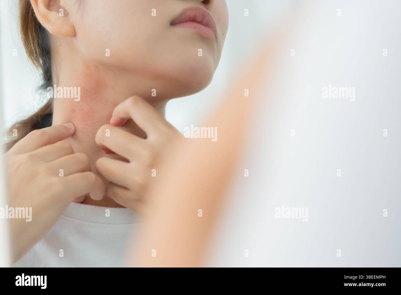Skin and beauty problems Women have itchy skin and red rashes from ...