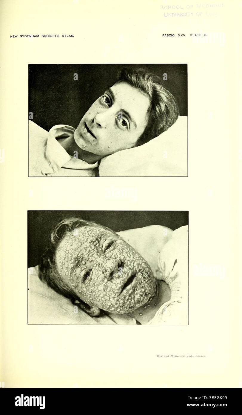 Photograph by Dr. Allan Warner from 1901 showing two sisters with ...