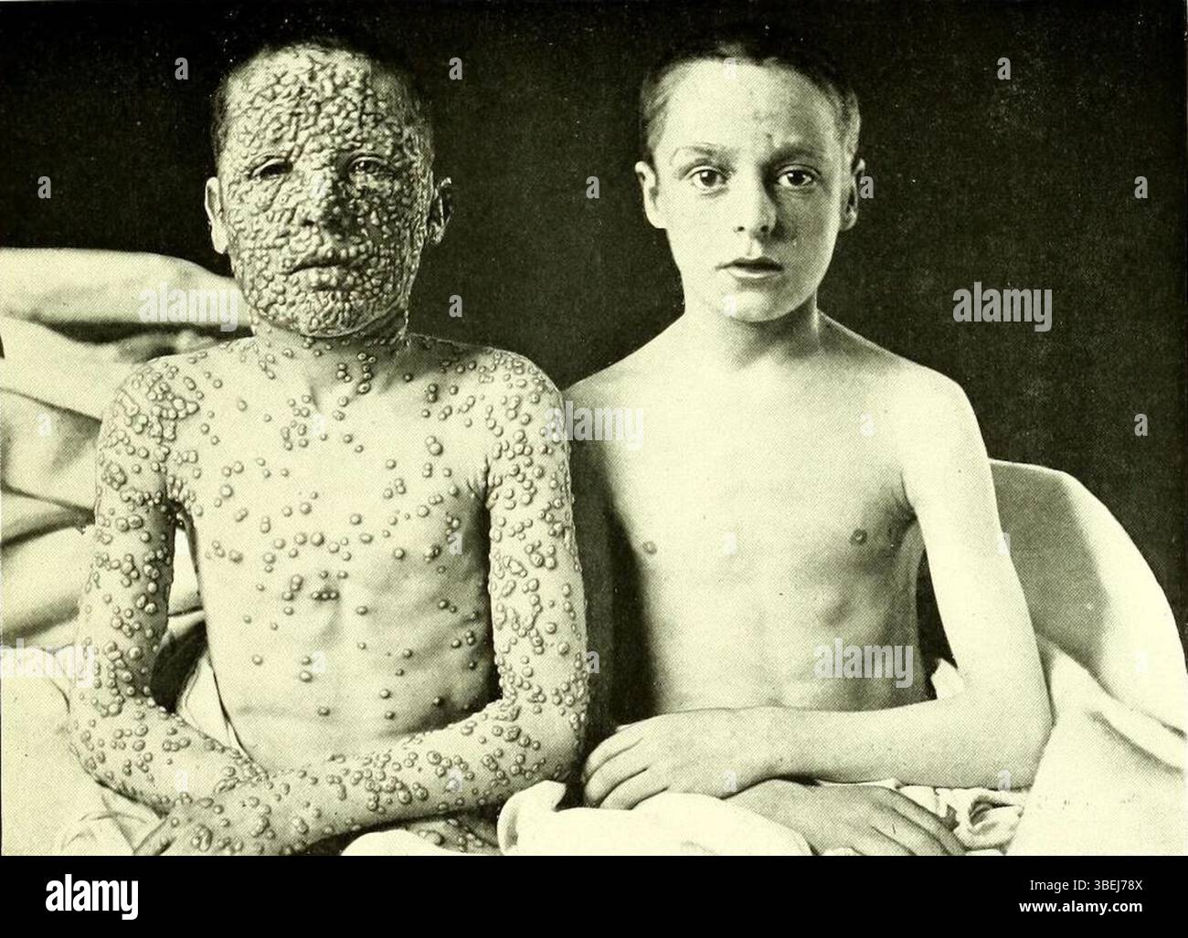 1901 photograph by Dr. Allan Warner showing two 13-year-old boys ...