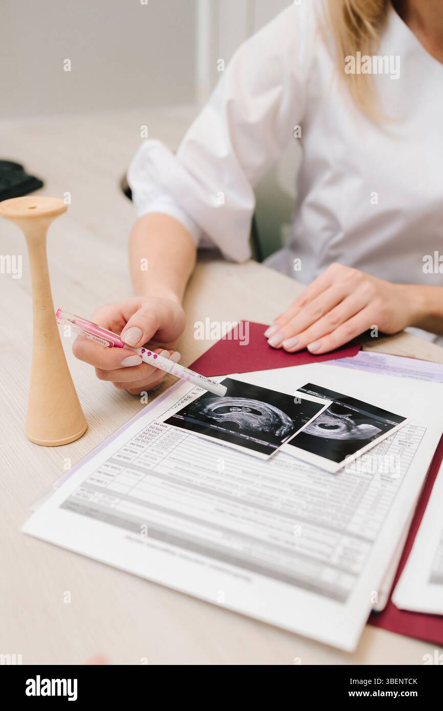 Gynecologist examines results of ultrasound embryo scan. Gynecologist ...