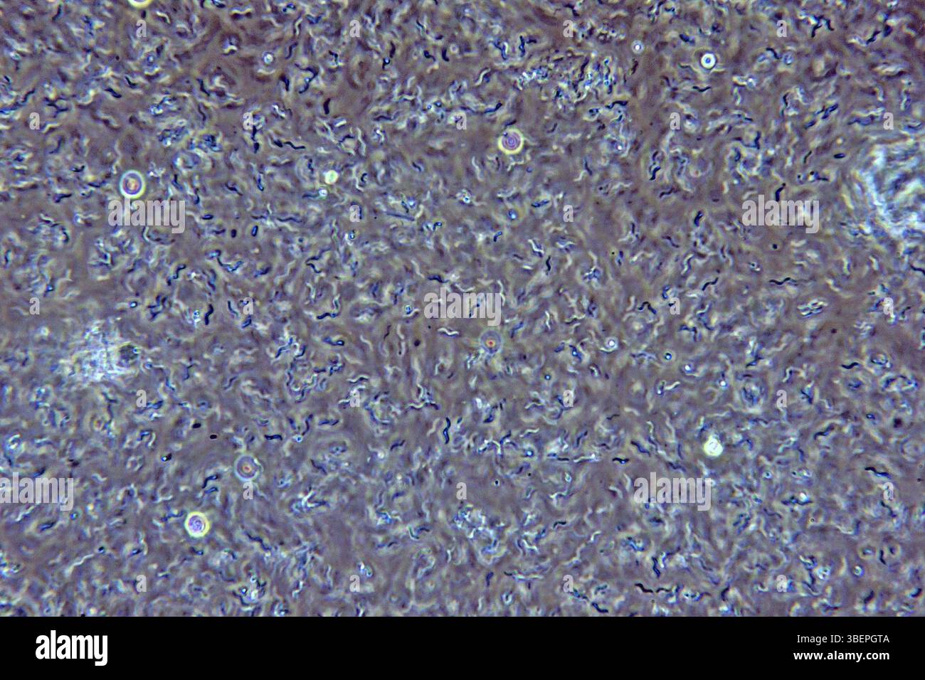 Spirilla in hay infusion 400x phase contrast Stock Photo - Alamy