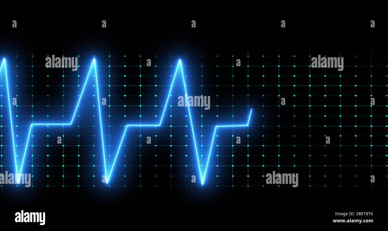 Image of cardiograph over black background Stock Photo - Alamy