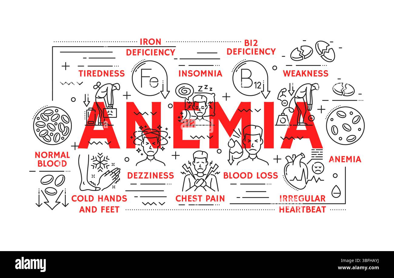 Anemia symptoms, hematology icons, anaemia disease treatment and iron ...