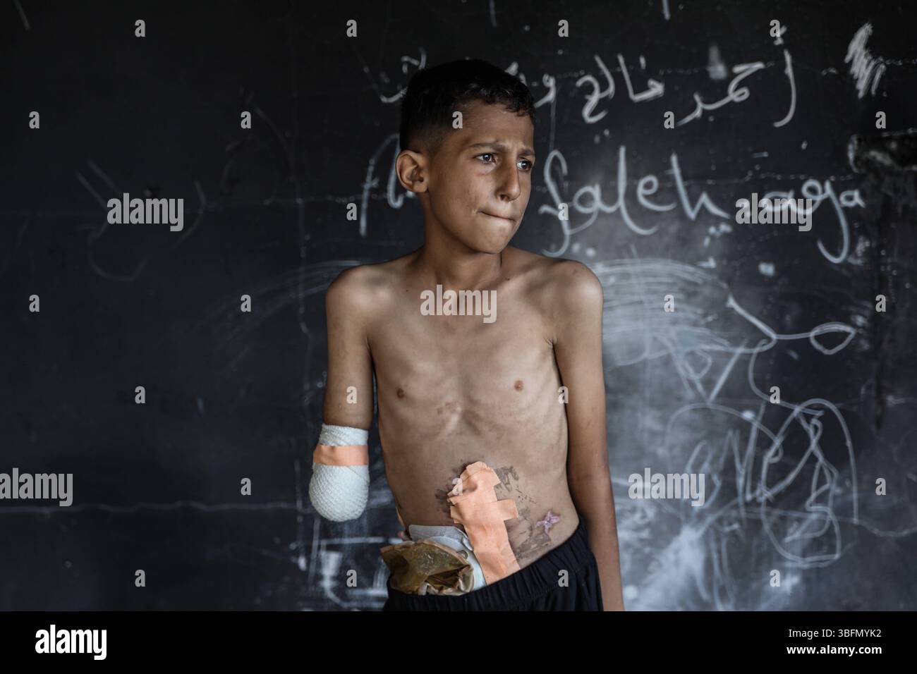 Ahmad Agha, a 14-year-old boy living in a shelter in Gaza City, who was ...