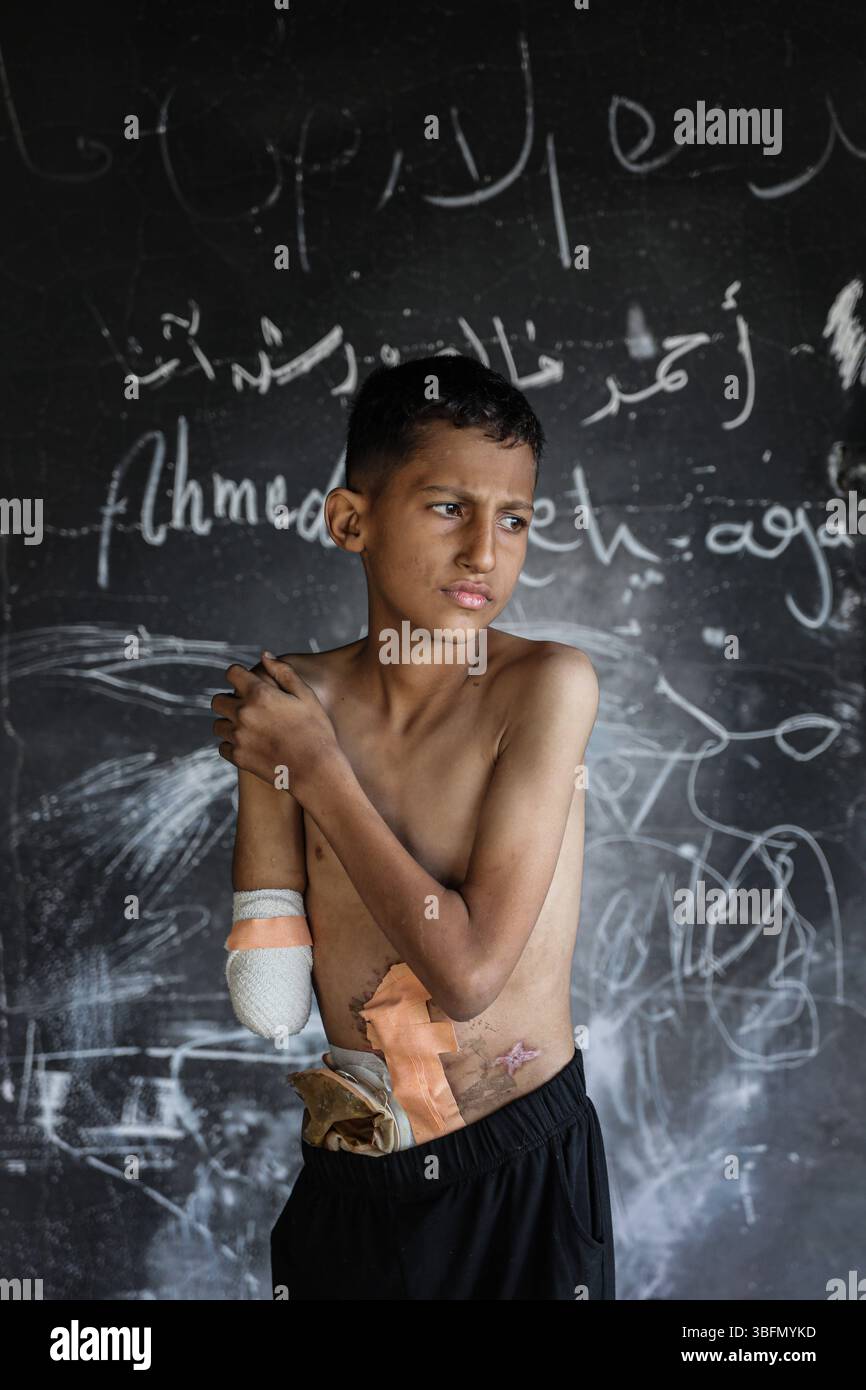 Ahmad Agha, a 14-year-old boy living in a shelter in Gaza City, who was ...