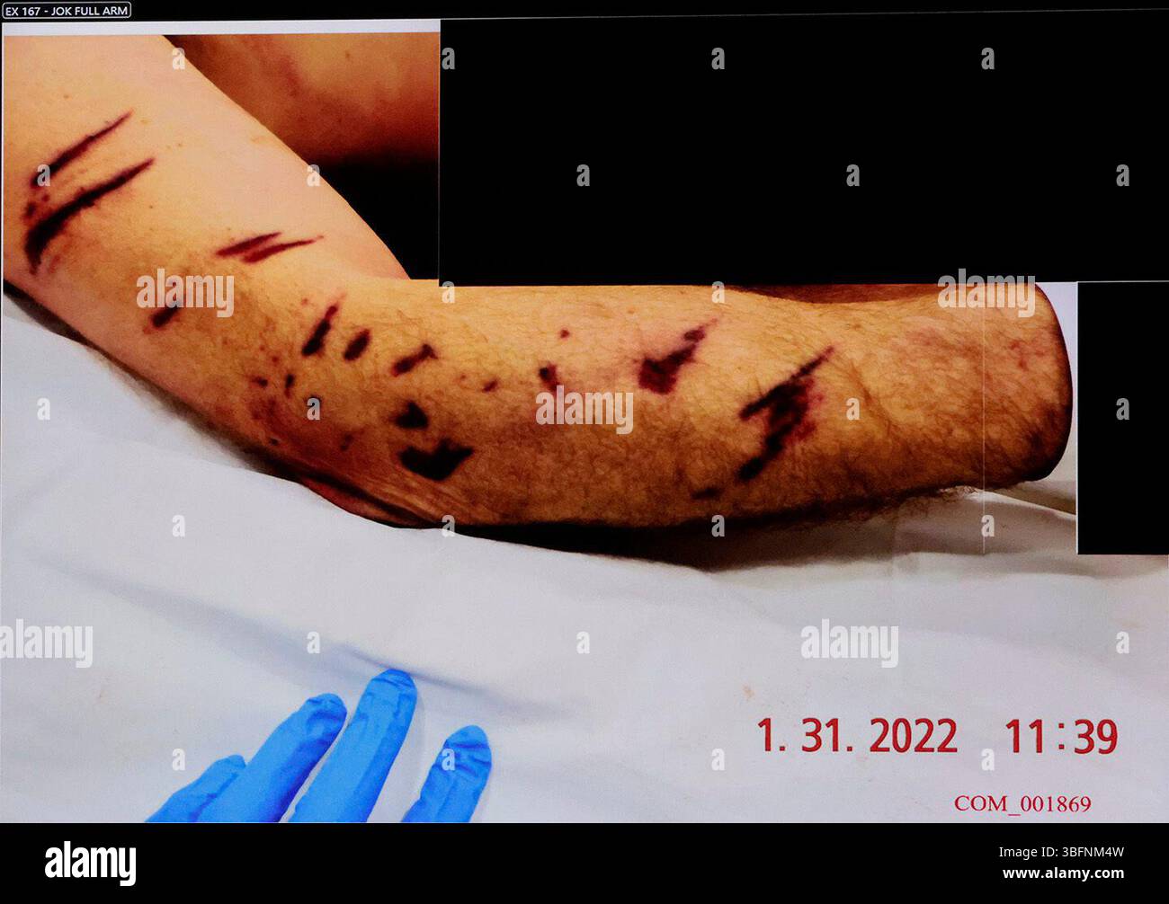 A photograph of John O'Keefe's right arm is republished during the ...