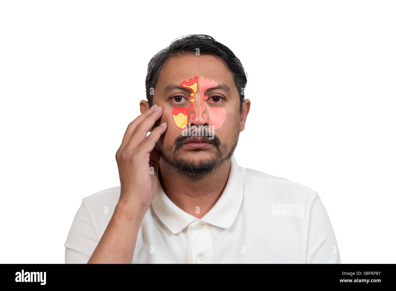 Portrait of Asian man showing symptoms of sinusitis with a medical ...
