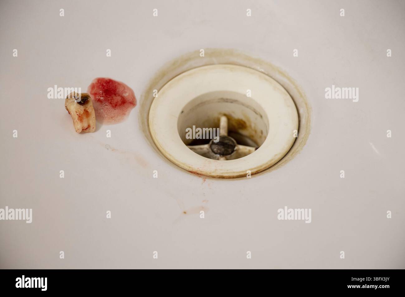 Lost rotten tooth and blood in the sink, dental problem, bleeding gums ...