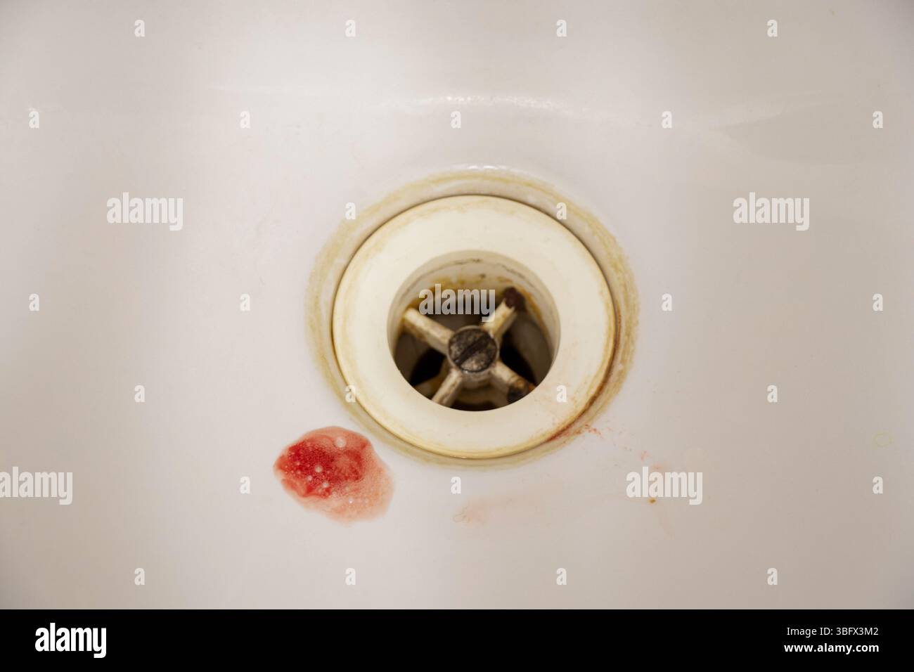 Saliva with blood in the sink, bleeding gums symptom, dental problem ...