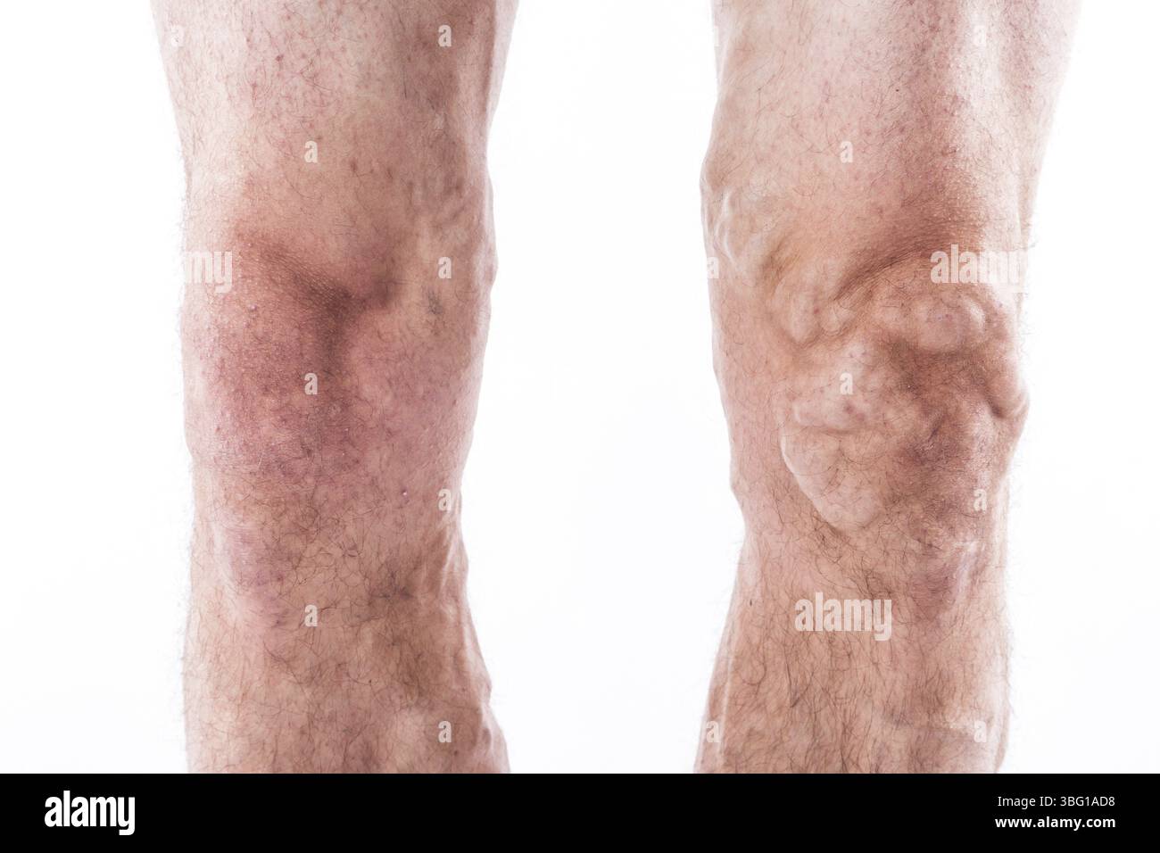 Human pressure on wildlife hi-res stock photography and images - Alamy