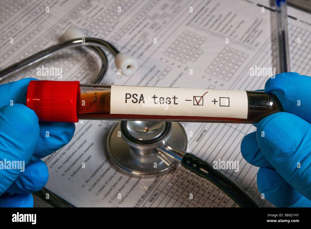 Doctor wearing blue gloves holding a test tube with negative psa test ...