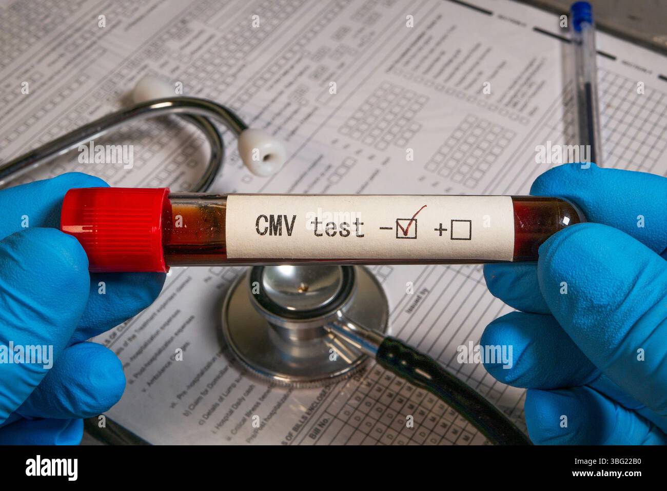 Doctor holding cmv test tube with negative result and stethoscope on a ...