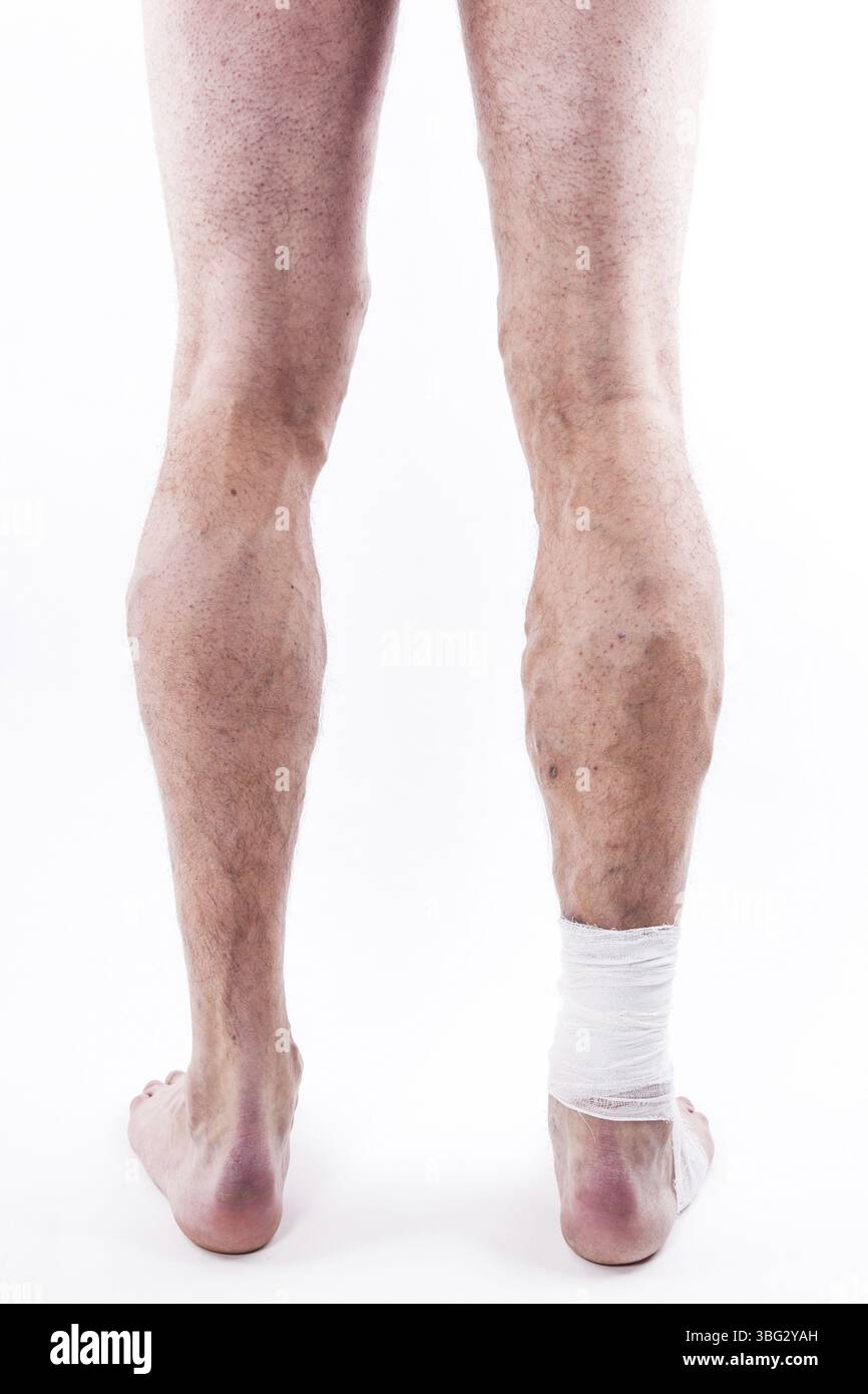 Human pressure on wildlife hi-res stock photography and images - Alamy