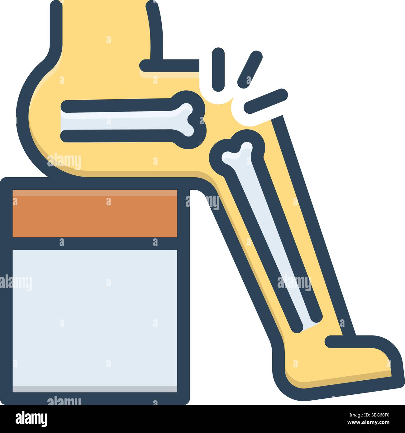 Joint inflammation illustration Stock Vector Images - Alamy