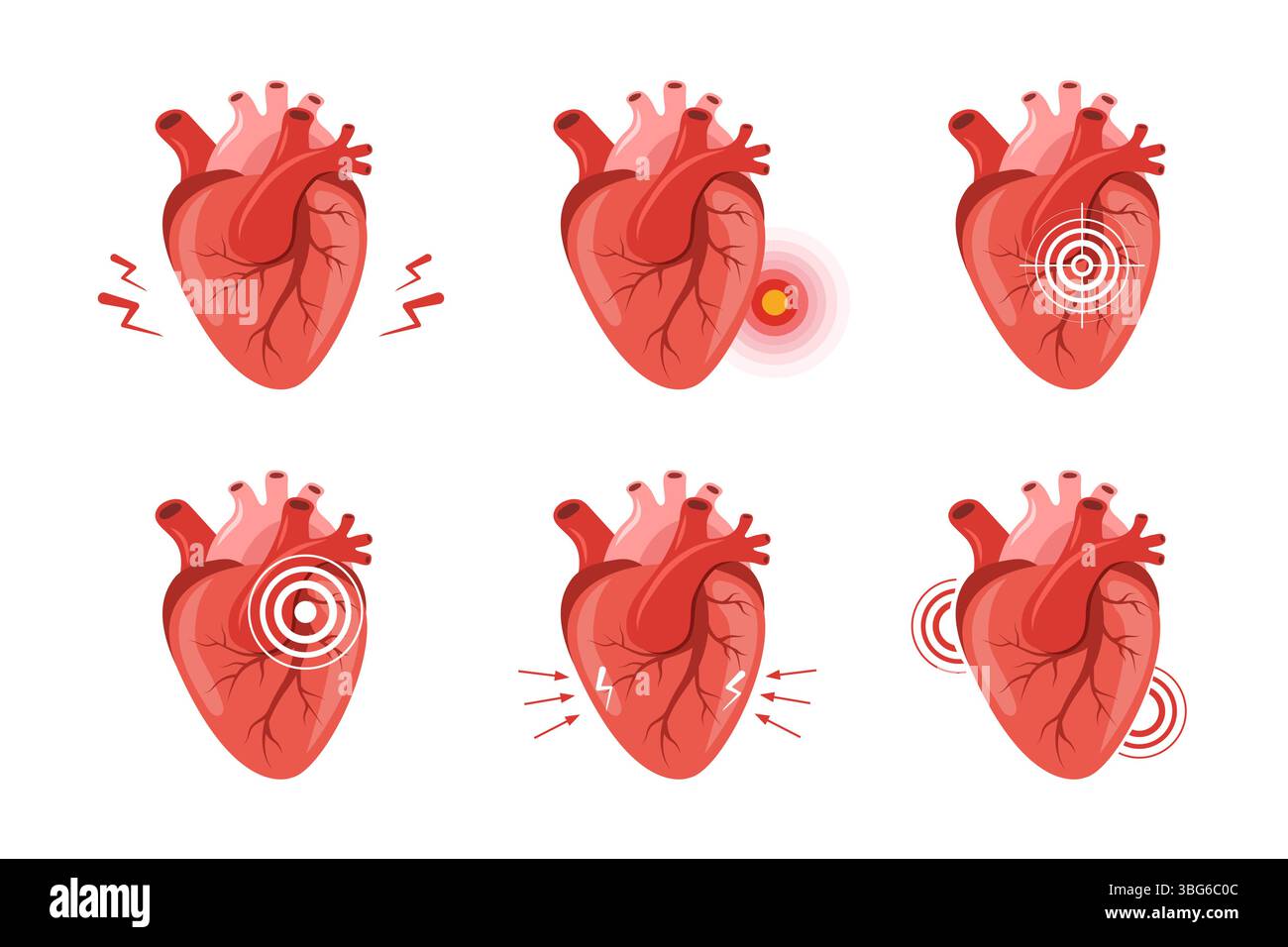 Heart pain. Human internal organ disease. Heart medical diagnosis and ...