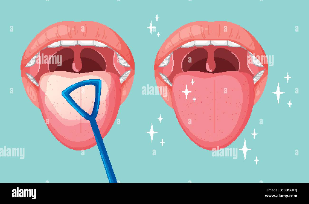 Illustration of tongue cleaning for better oral health Stock Vector ...