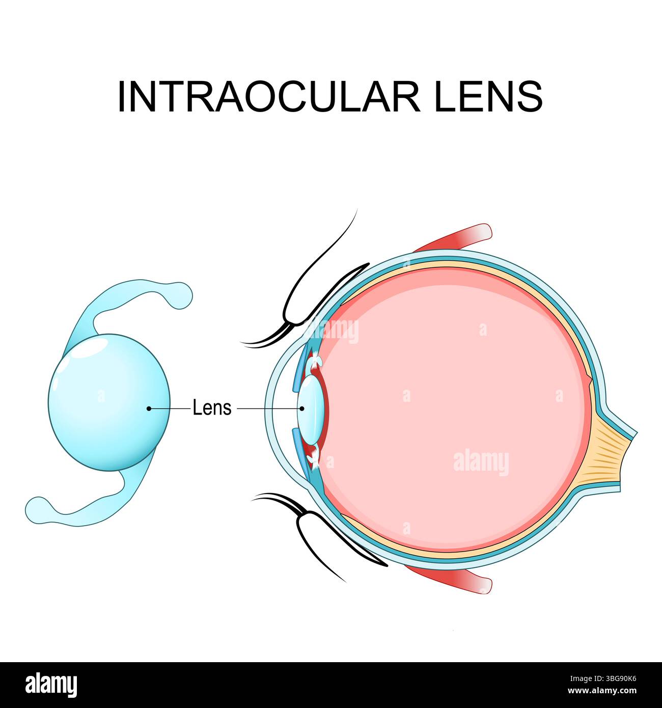 Lens Eye Diagram