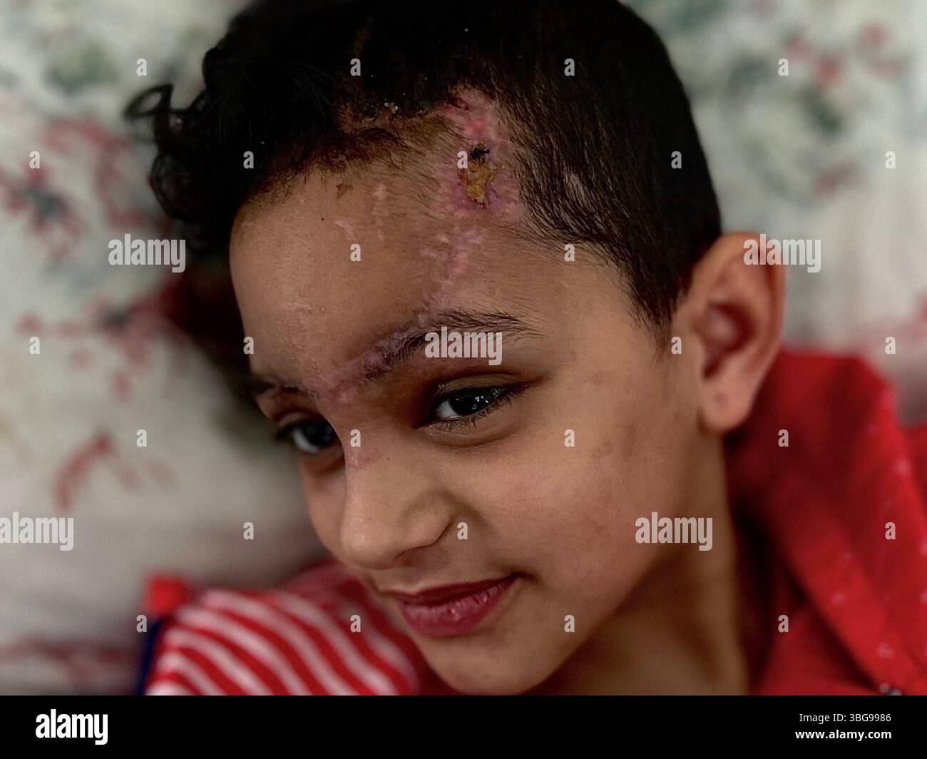 Palestinian children are receiving medical care at Nasser Medical ...