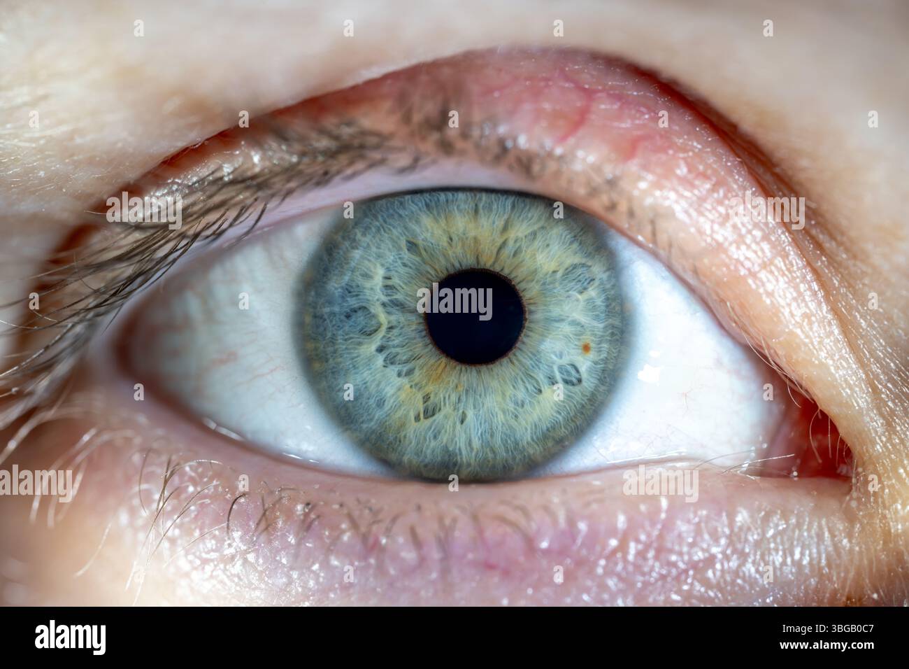 Description: Female eye with green coloured closed iris. Structural and ...