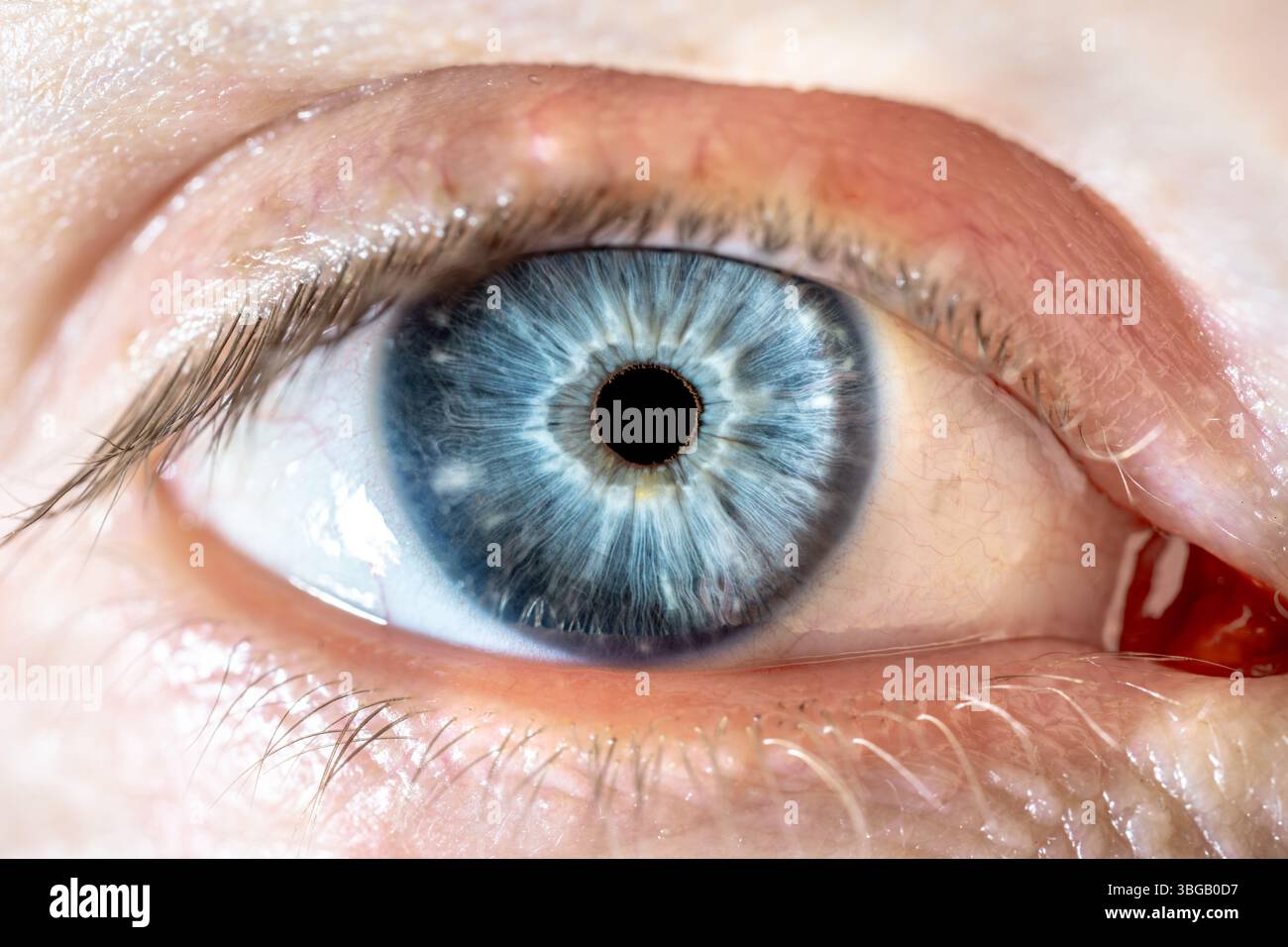 Description: Male eye with blue coloured closed iris. Structural and ...