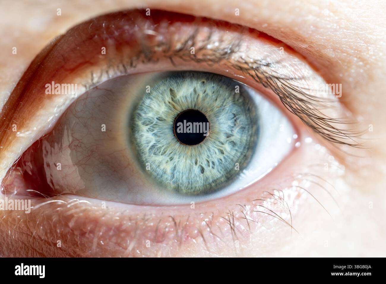 Description: Female eye with blue-green coloured closed iris ...