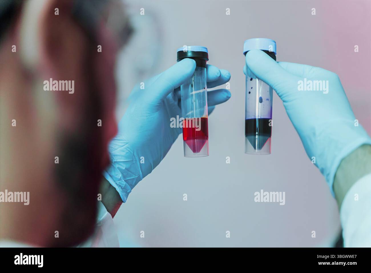 Doctor comparing results sample hi-res stock photography and images - Alamy