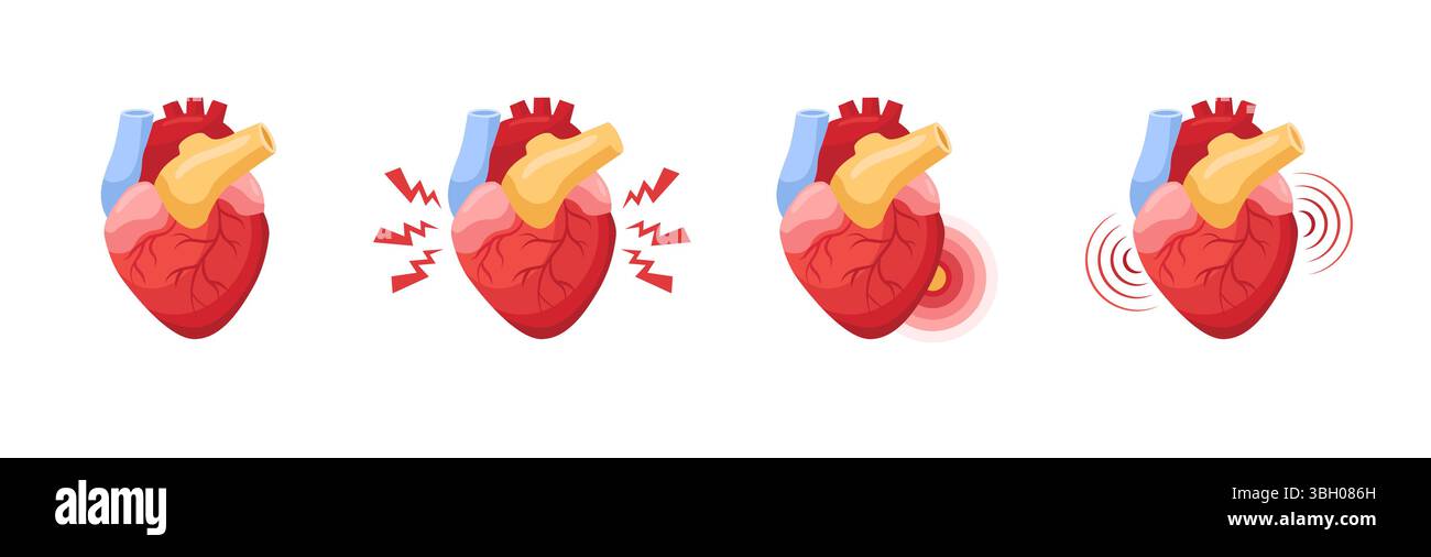 Heart animation showing different stages of pain from mild discomfort ...