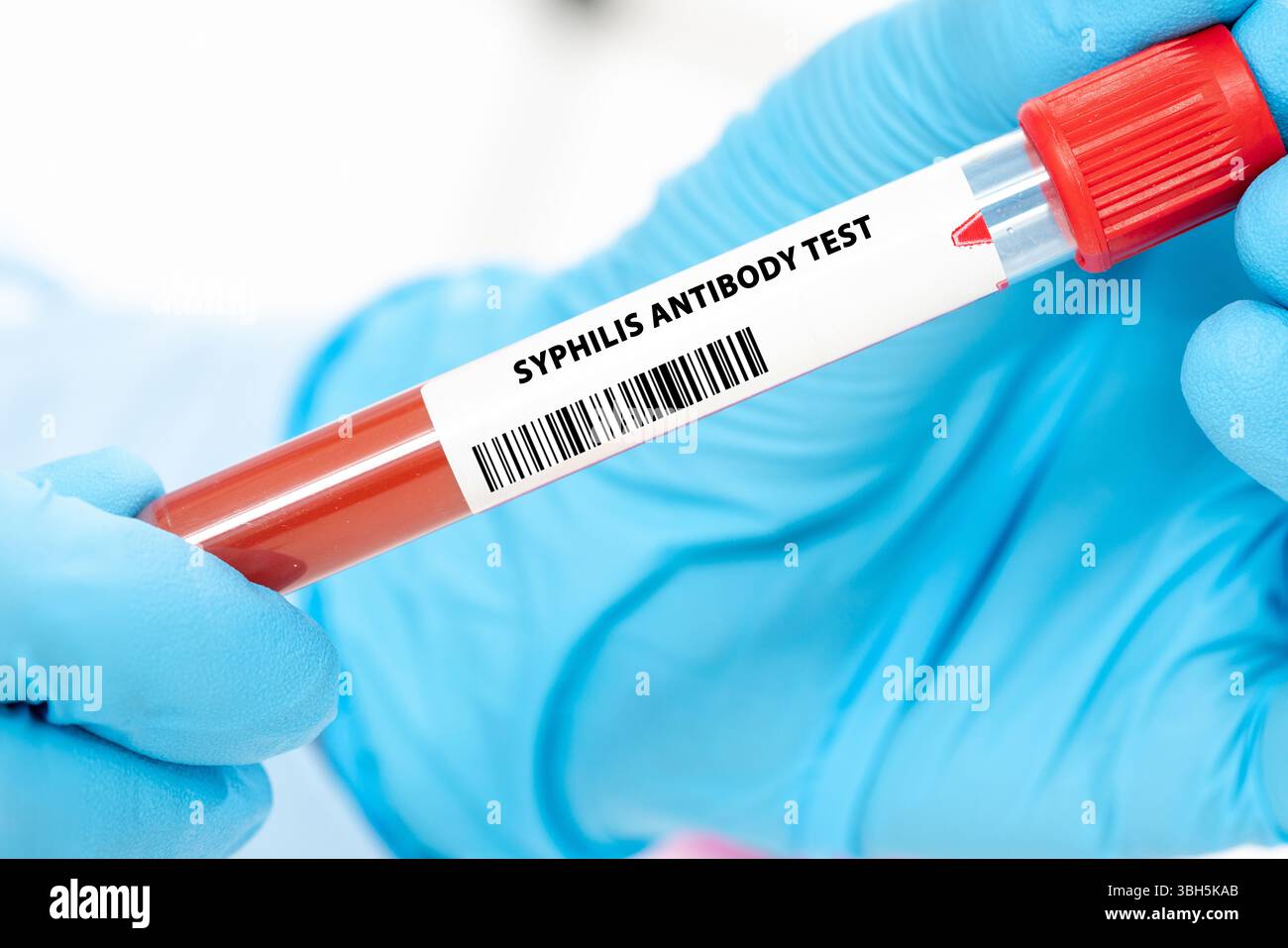 Syphilis antibody test. Detects antibodies to Treponema pallidum to ...