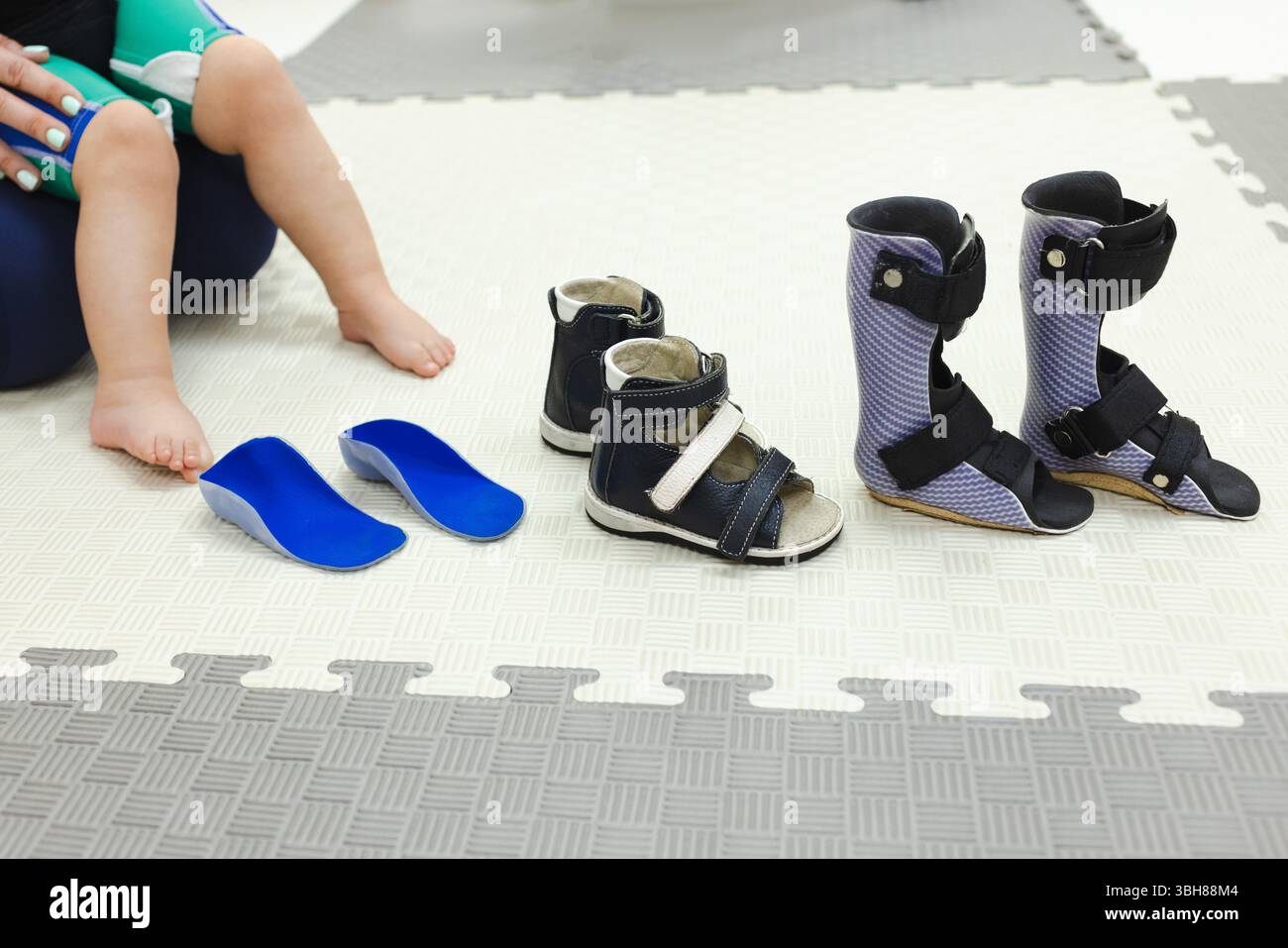 Selection of right orthopedic shoes or orthoses for child with valgus ...