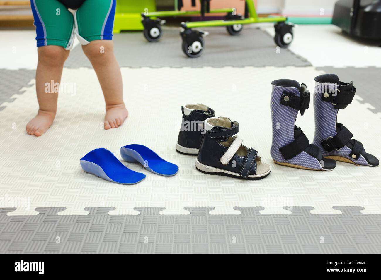 Orthopedic shoes for treatment of foot deformities. Selection of right ...