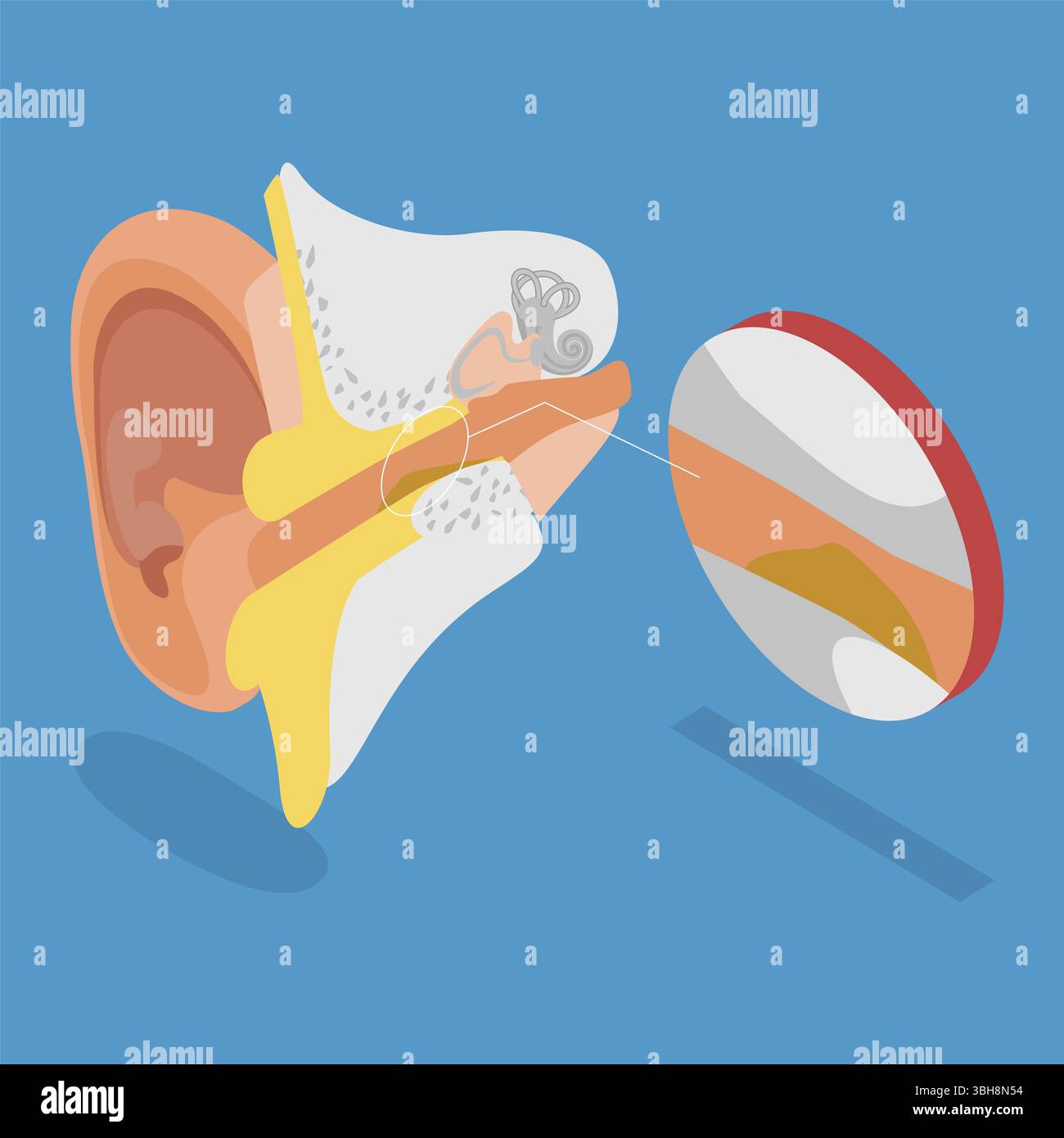 Ear wax hi-res stock photography and images - Alamy