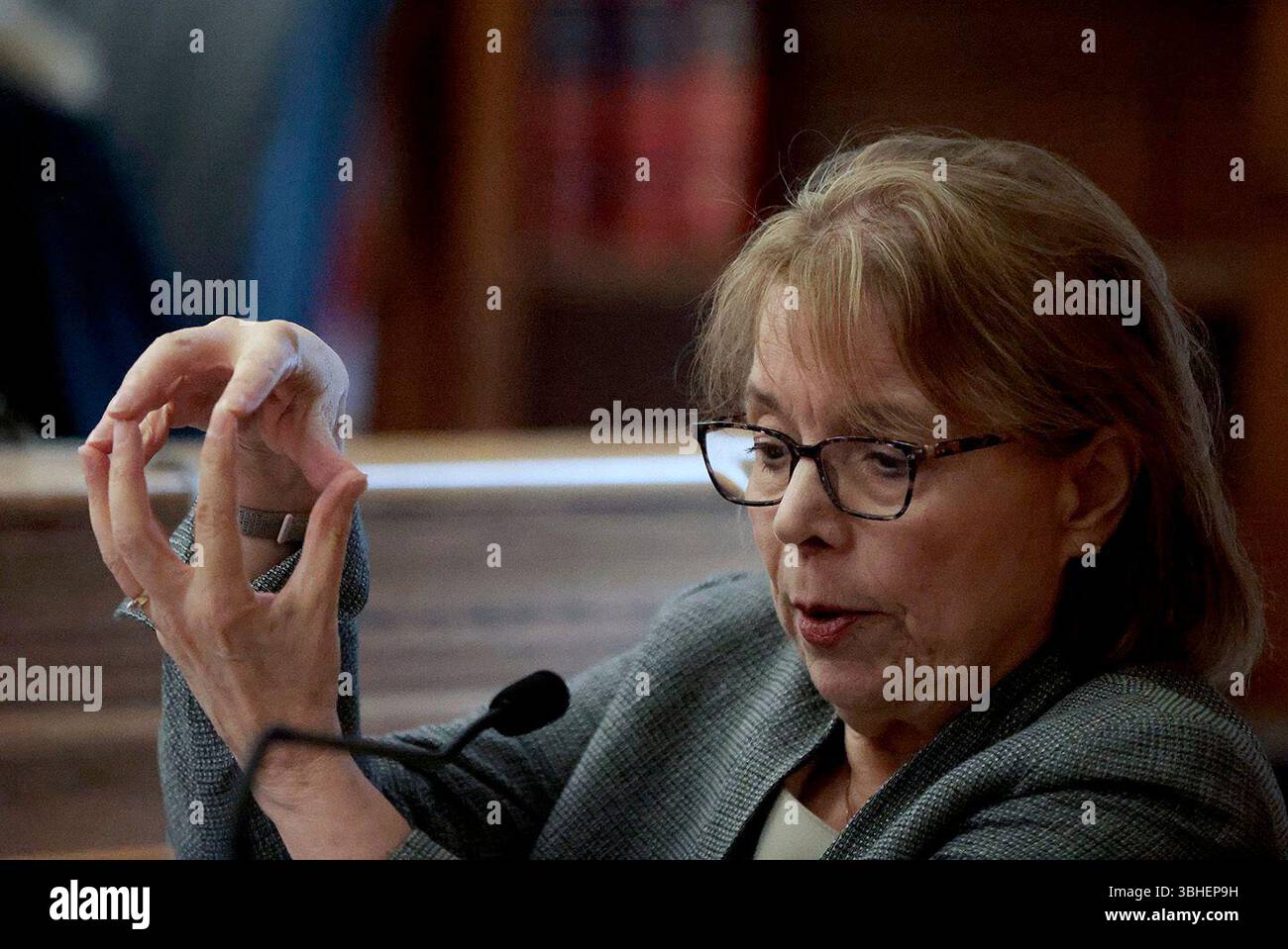 Dr. Elizabeth Laposata defines a specific head injury for the defense ...