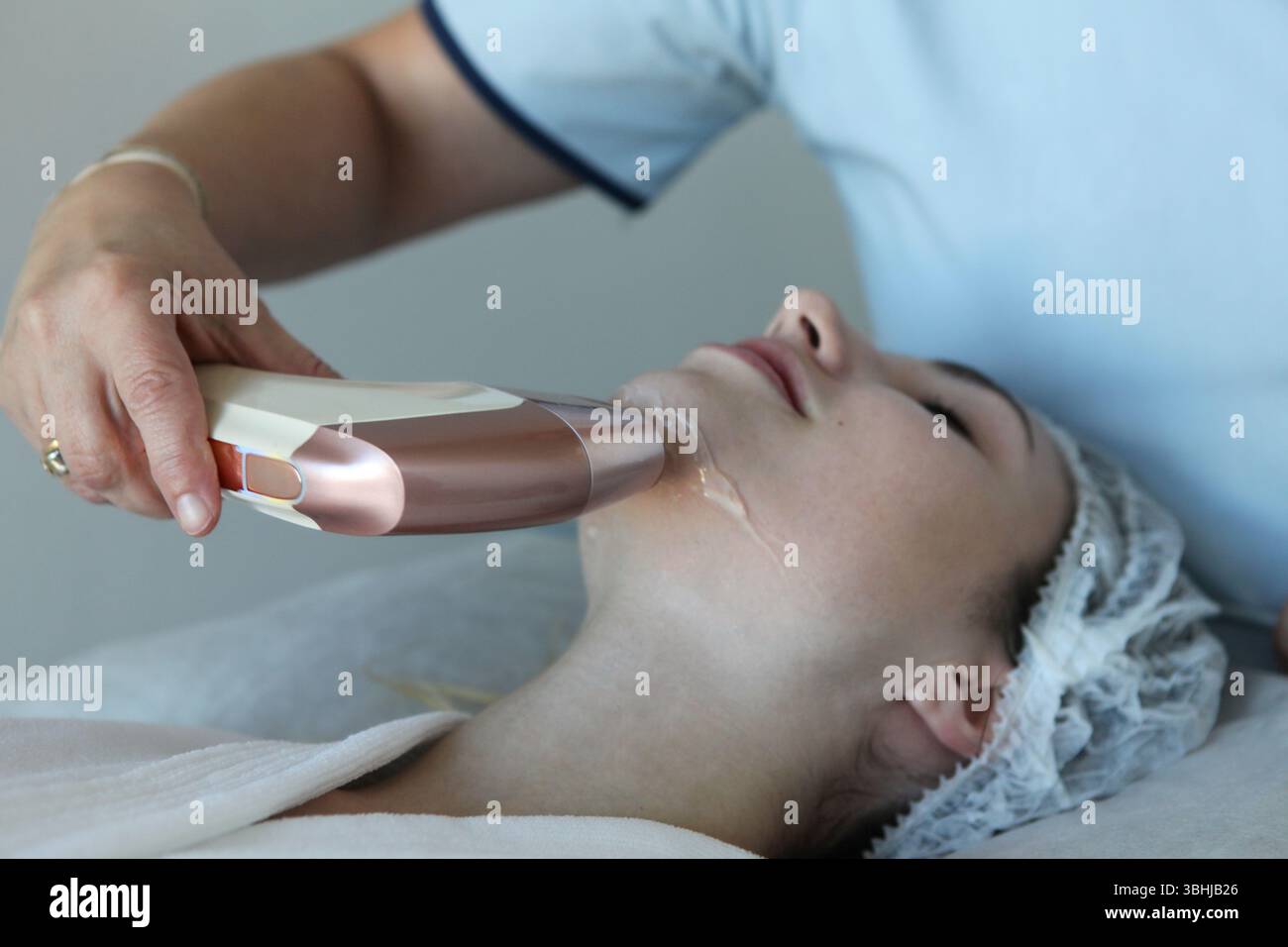 closeup portrait of young woman receives a HIFU (High-Intensity Focused Ultrasound) facial ...