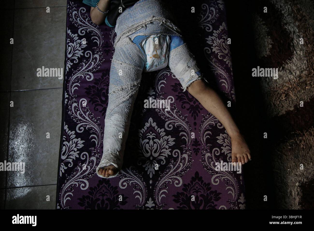 The Palestinian child Osama Assaf, 4 years old, is receiving medical care at his grandmothers ...