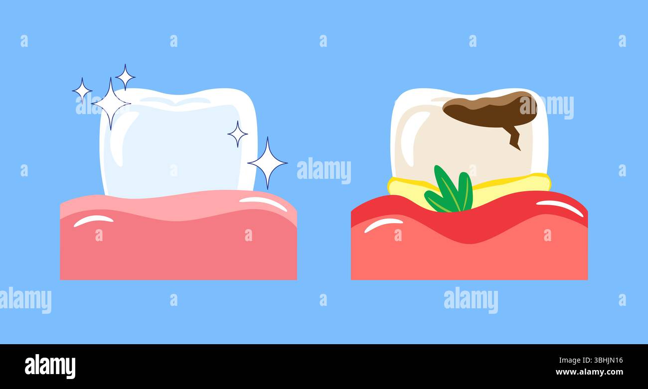 Periodontal disease . Included gingivitis, dental calculus, gum ...