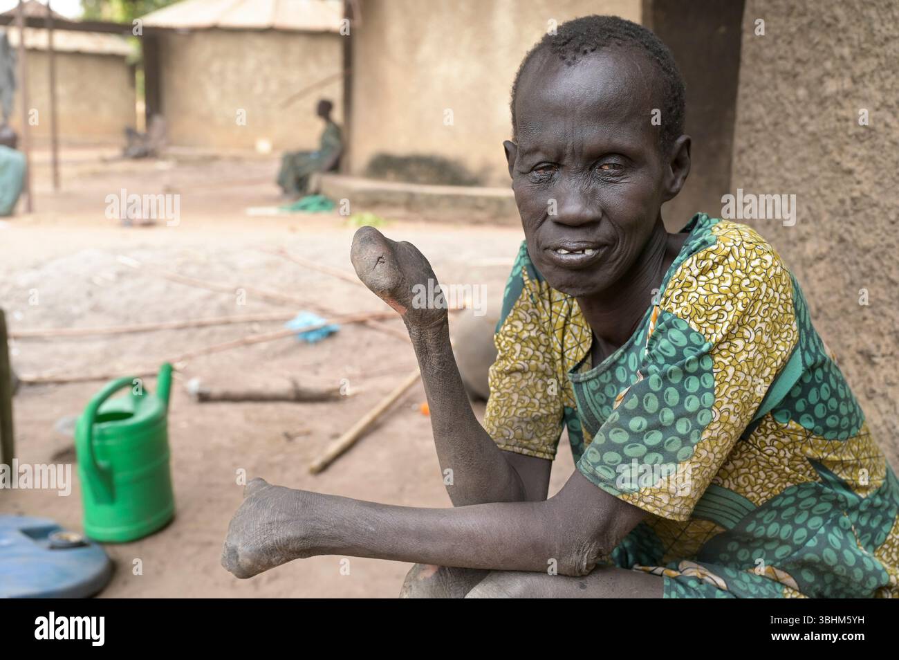 SOUTH-SUDAN, state Western Bahr el Ghazal, town Wau, village Agok for ...