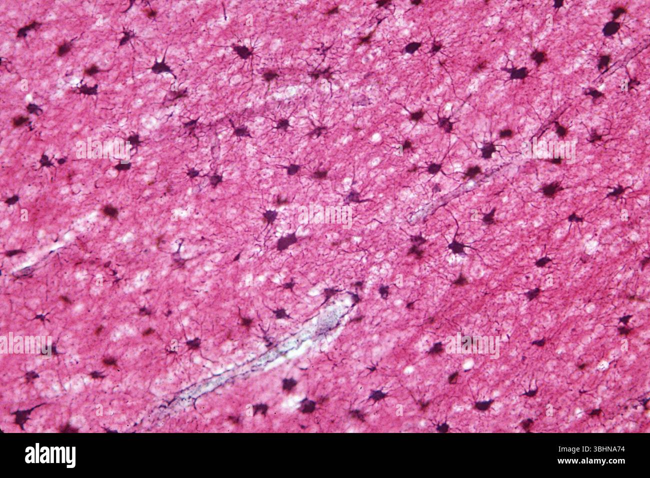 Light micrograph showing fibrous astrocytes in the brain white matter ...