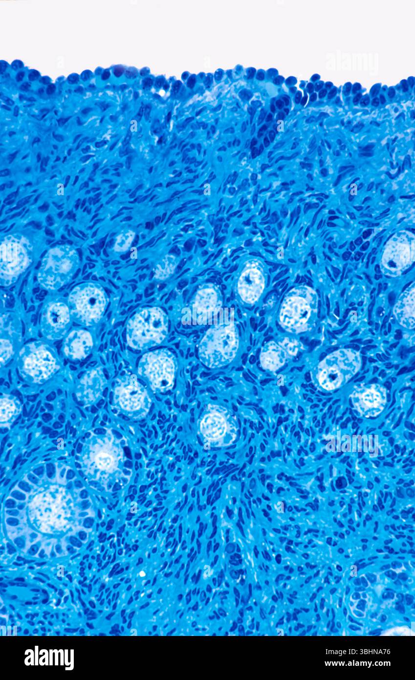 Light micrograph of the ovarian cortex showing, from top to bottom, the ...